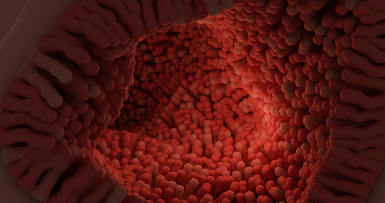 Quelles sont les causes du SIBO "Small intestinal bacterial overgroth"